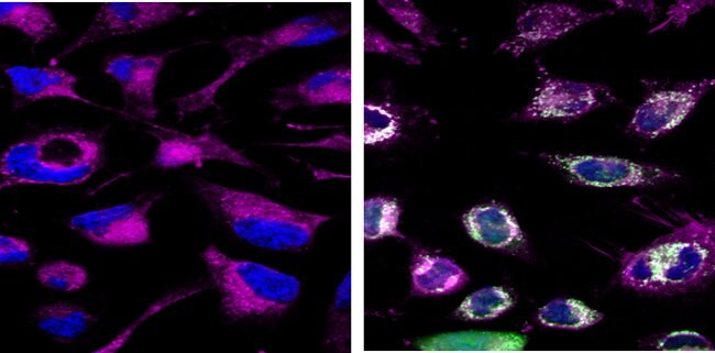 Image-iT™ Green Hypoxia Reagent