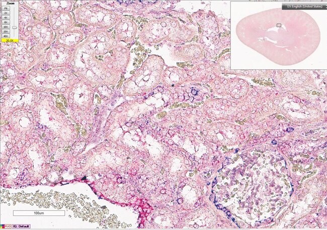 ViewRNA™ Tissue Assay Blue Module