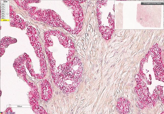 ViewRNA™ Tissue Assay Blue Module