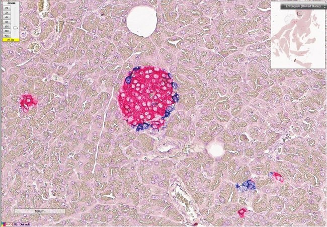 ViewRNA™ Tissue Assay Blue Module