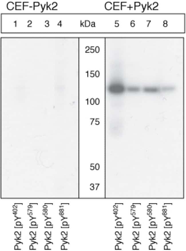 Pyk2 Antibody Sampler Pack