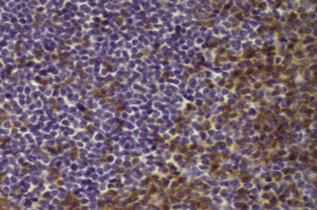 eBioscience™ DAB Advanced Chromogenic Kit