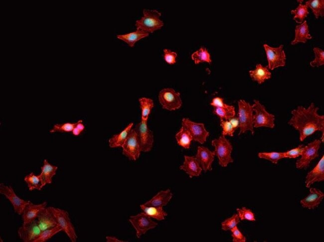 ProLong™ Diamond Antifade Mountant