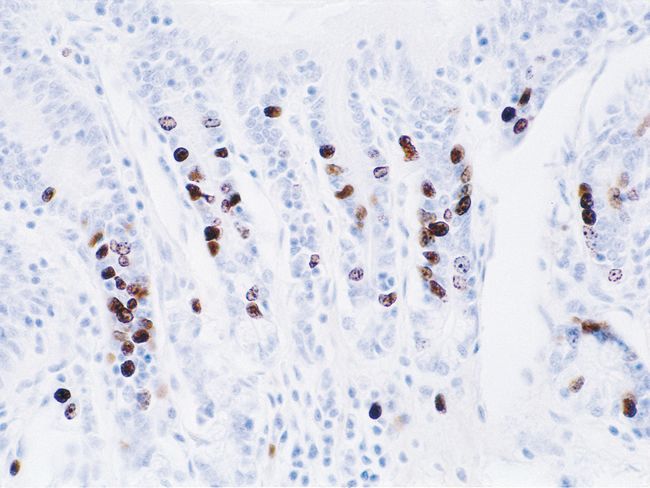 Brdu Antibody 03 3900