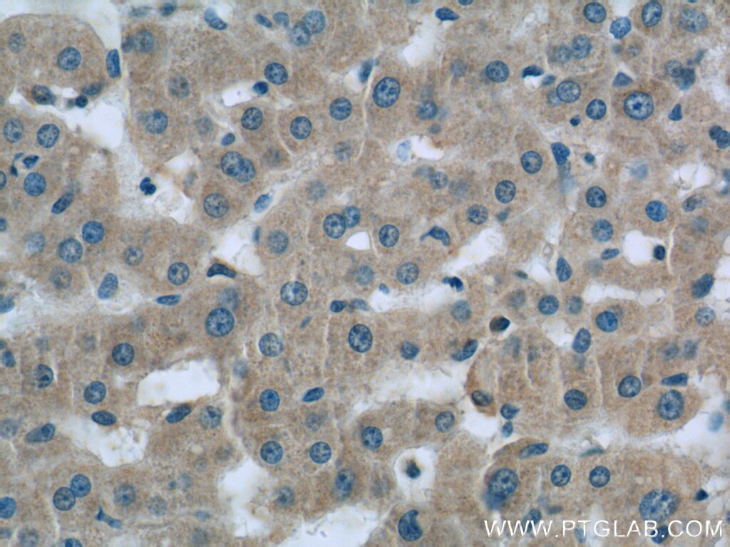 Complement factor B Antibody (10170-1-AP)