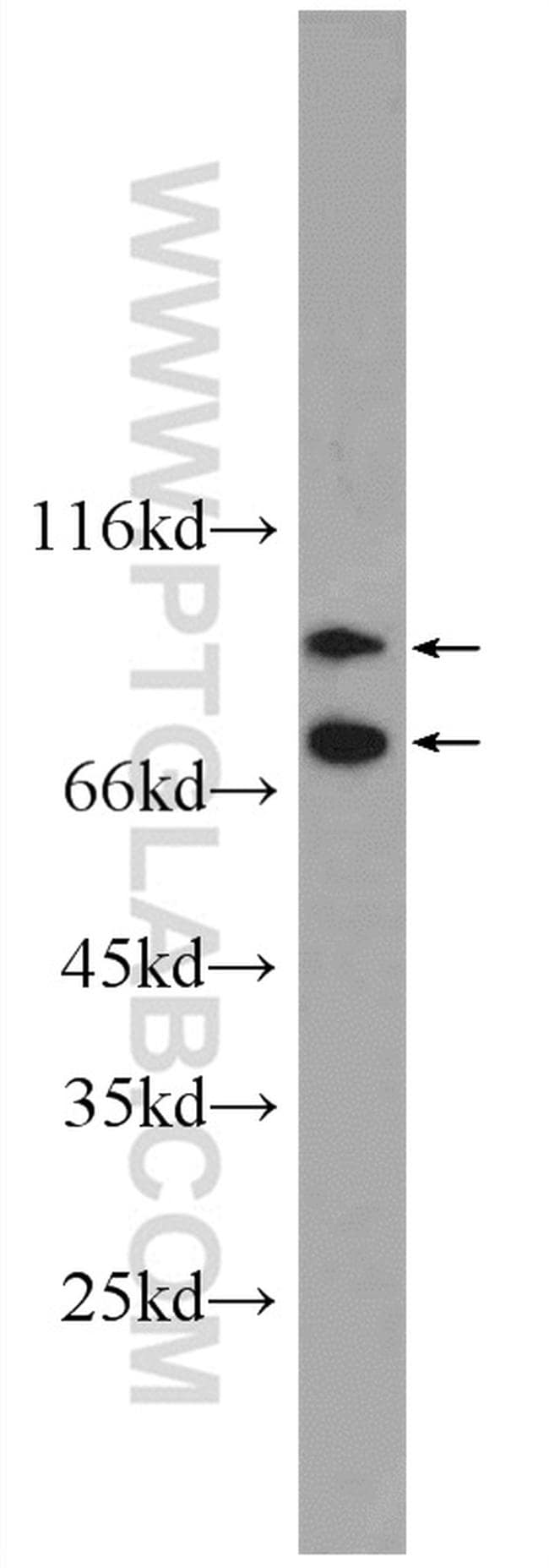 Complement factor B Antibody (10170-1-AP)