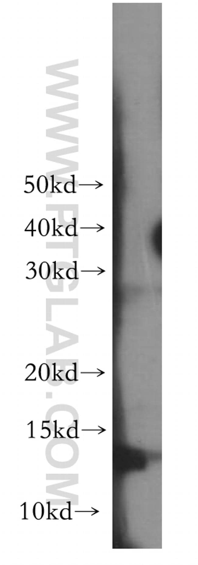 RAMP1 Antibody (10327-1-AP)