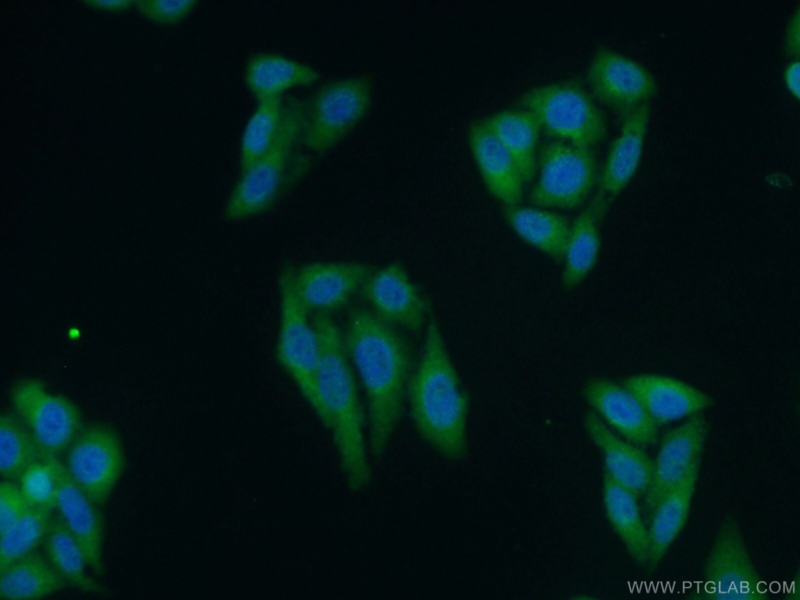 PMM2 Antibody (10666-1-AP)
