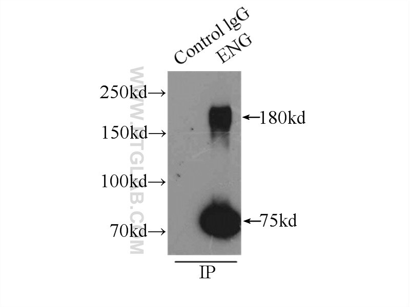 Endoglin/CD105 Antibody (10862-1-AP)