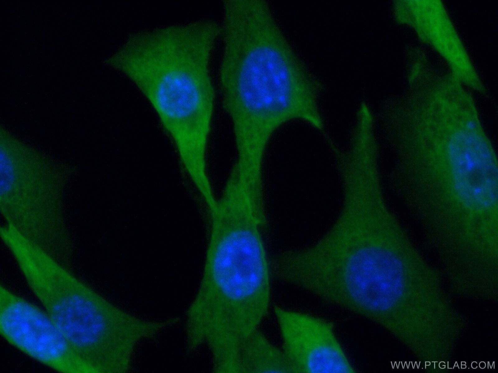 MTAP Antibody (11475-1-AP)