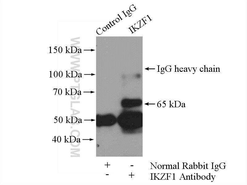 IKZF1 Antibody (12016-1-AP)