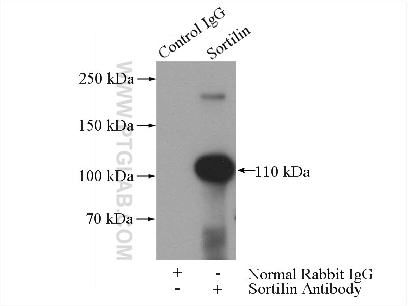 Sortilin Antibody (12369-1-AP)