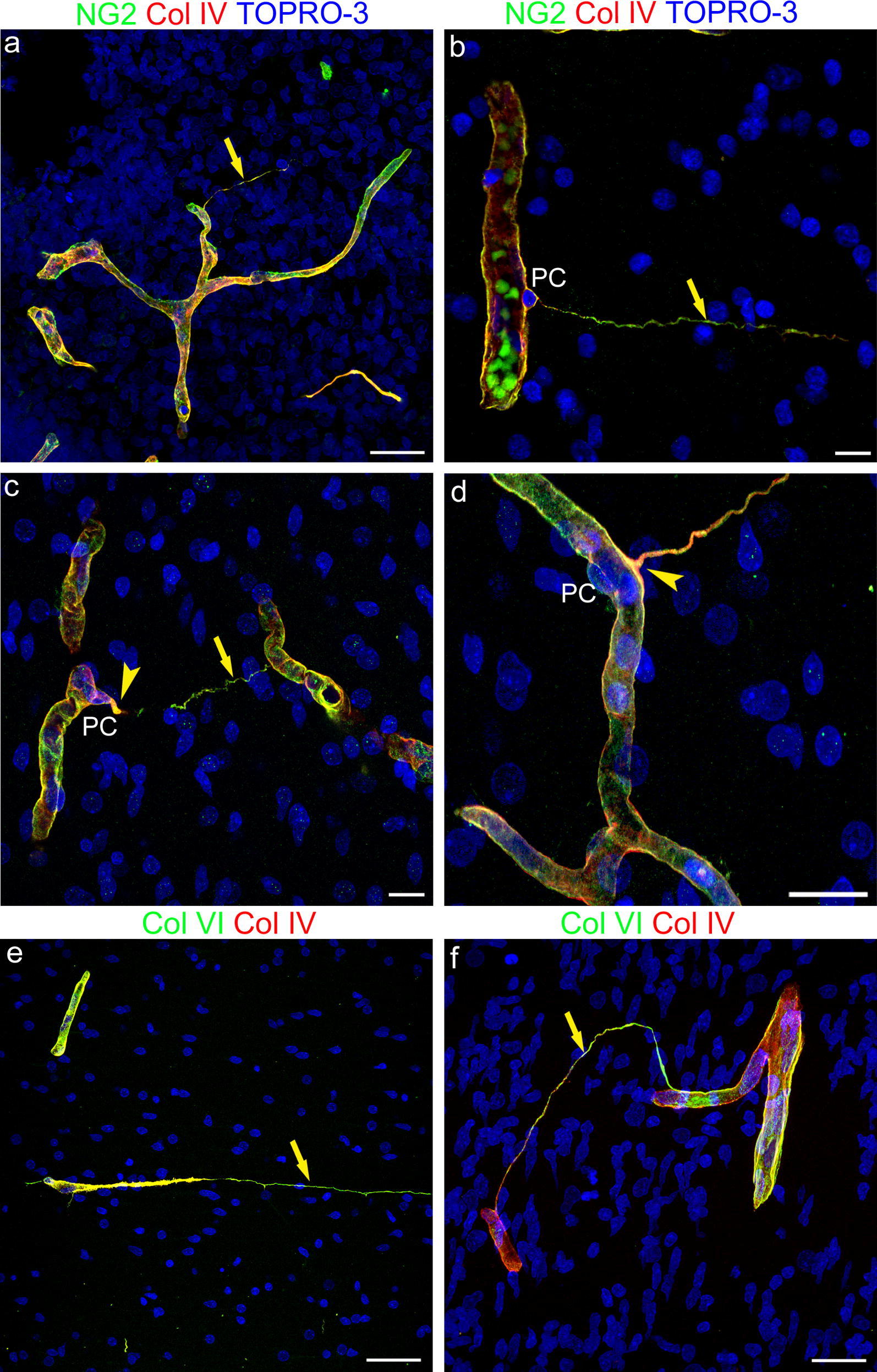 Neural/Glial Antigen 2 (NG2) Antibody (14-6504-82)