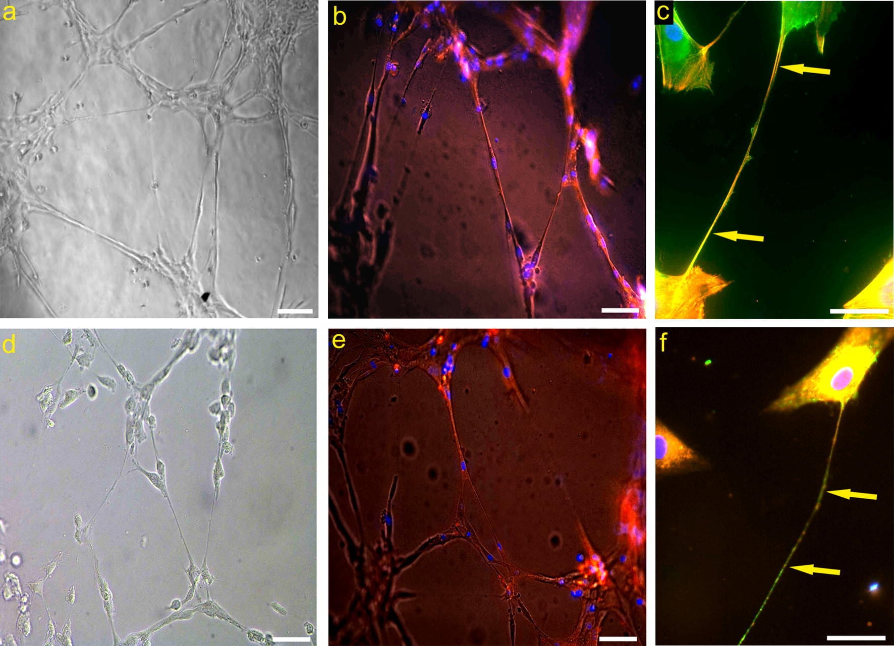 Neural/Glial Antigen 2 (NG2) Antibody (14-6504-82)