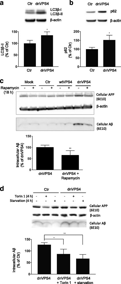 Amyloid Precursor Protein Antibody (OMA1-03132)