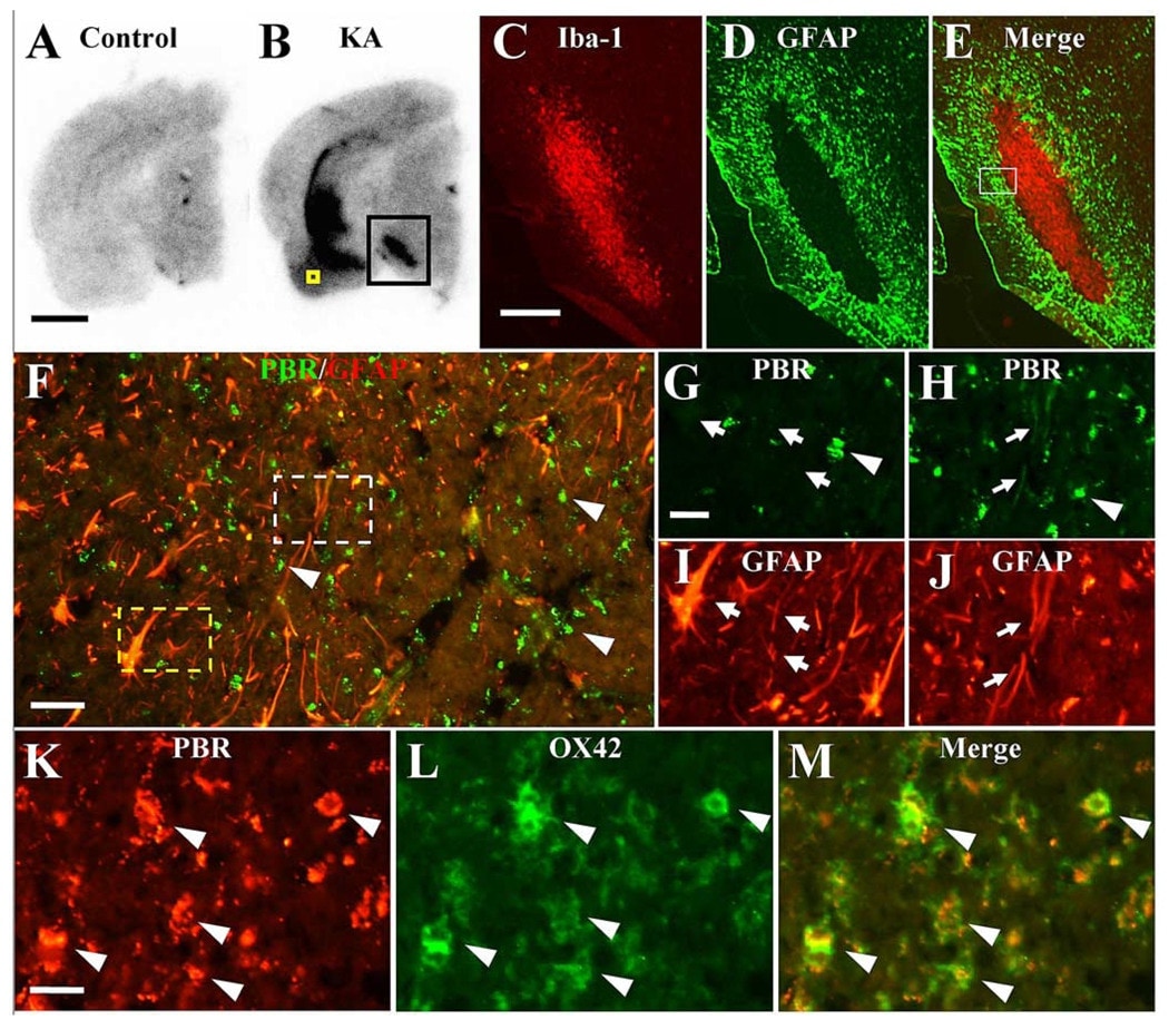 GFAP Antibody (Monoclonal, 2.2B10)