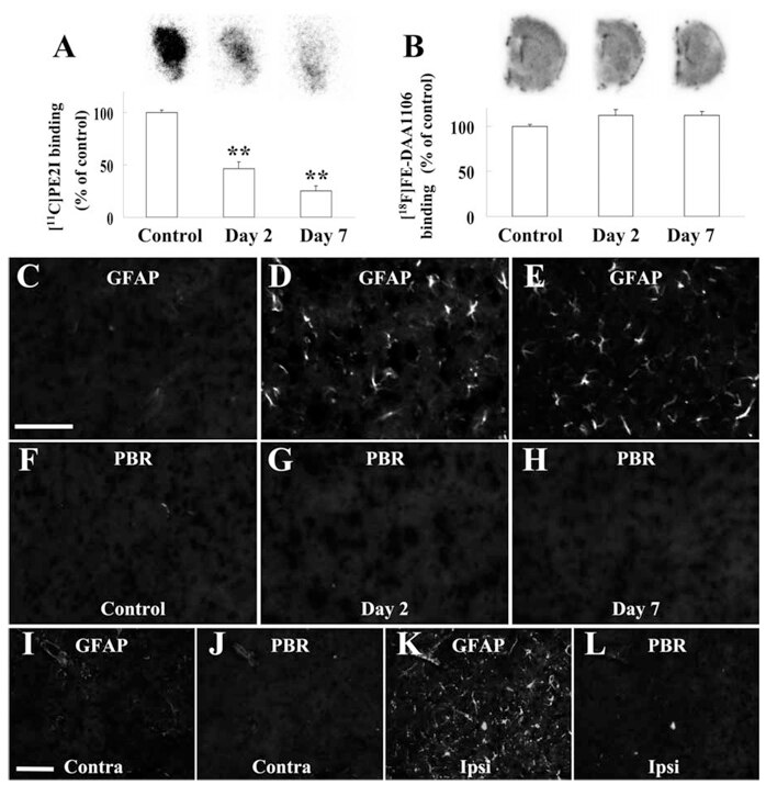 GFAP Antibody (Monoclonal, 2.2B10)