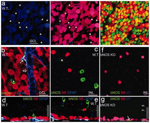 GFAP Antibody (Monoclonal, 2.2B10)