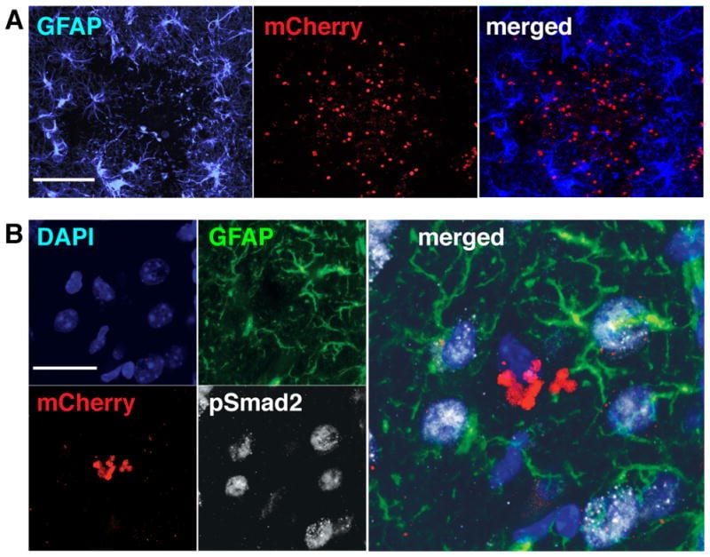 GFAP Antibody (Monoclonal, 2.2B10)