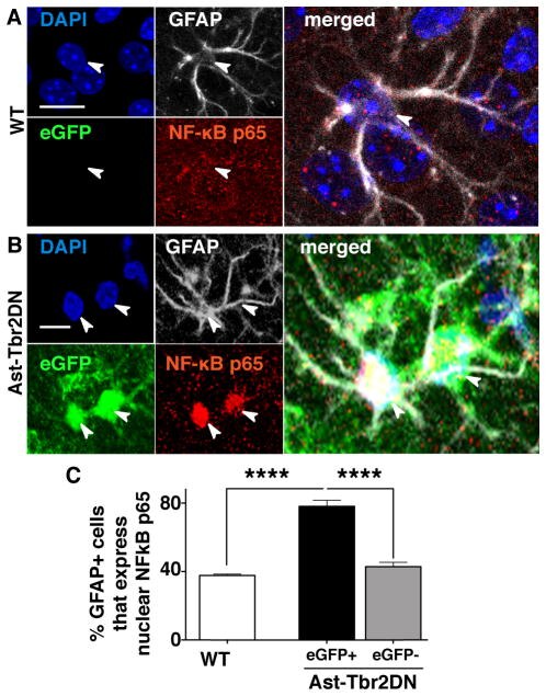 GFAP Antibody (Monoclonal, 2.2B10)