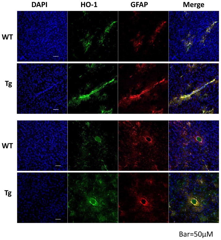 GFAP Antibody (13-0300)