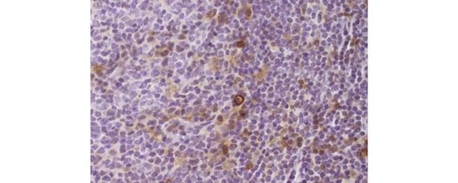 CD25 Antibody (14-0256-82)