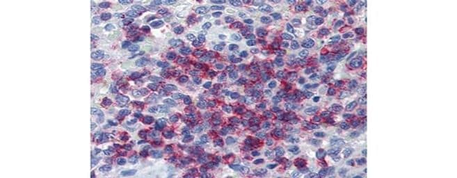 CD43 Antibody (14-0439-82)