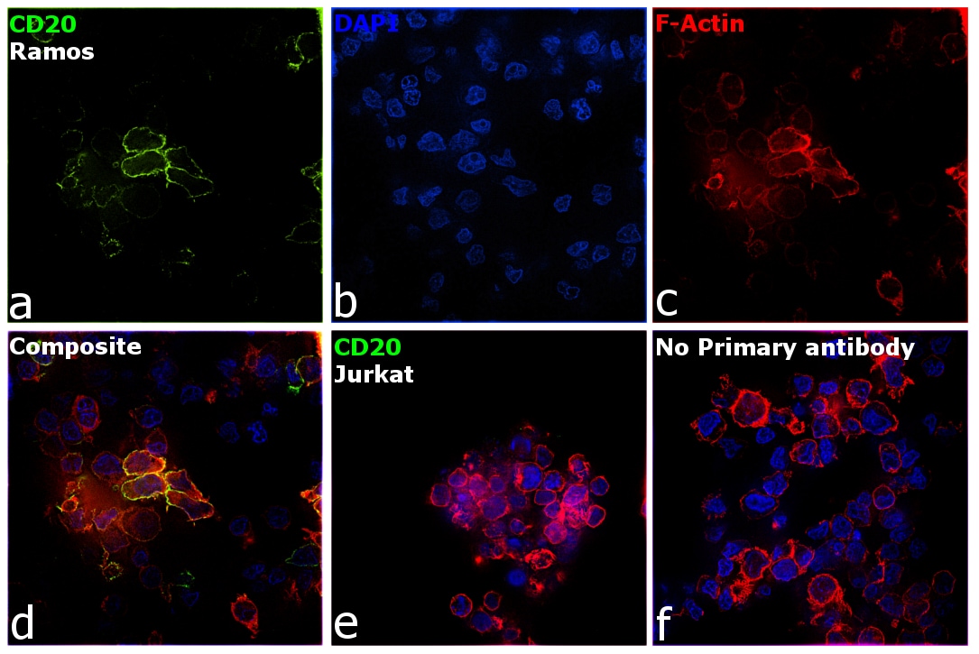 CD20 Antibody (14-0209-82)