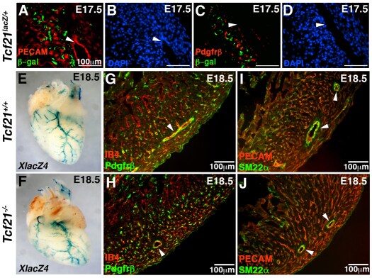 CD140b (PDGFRB) Antibody (Monoclonal, APB5)