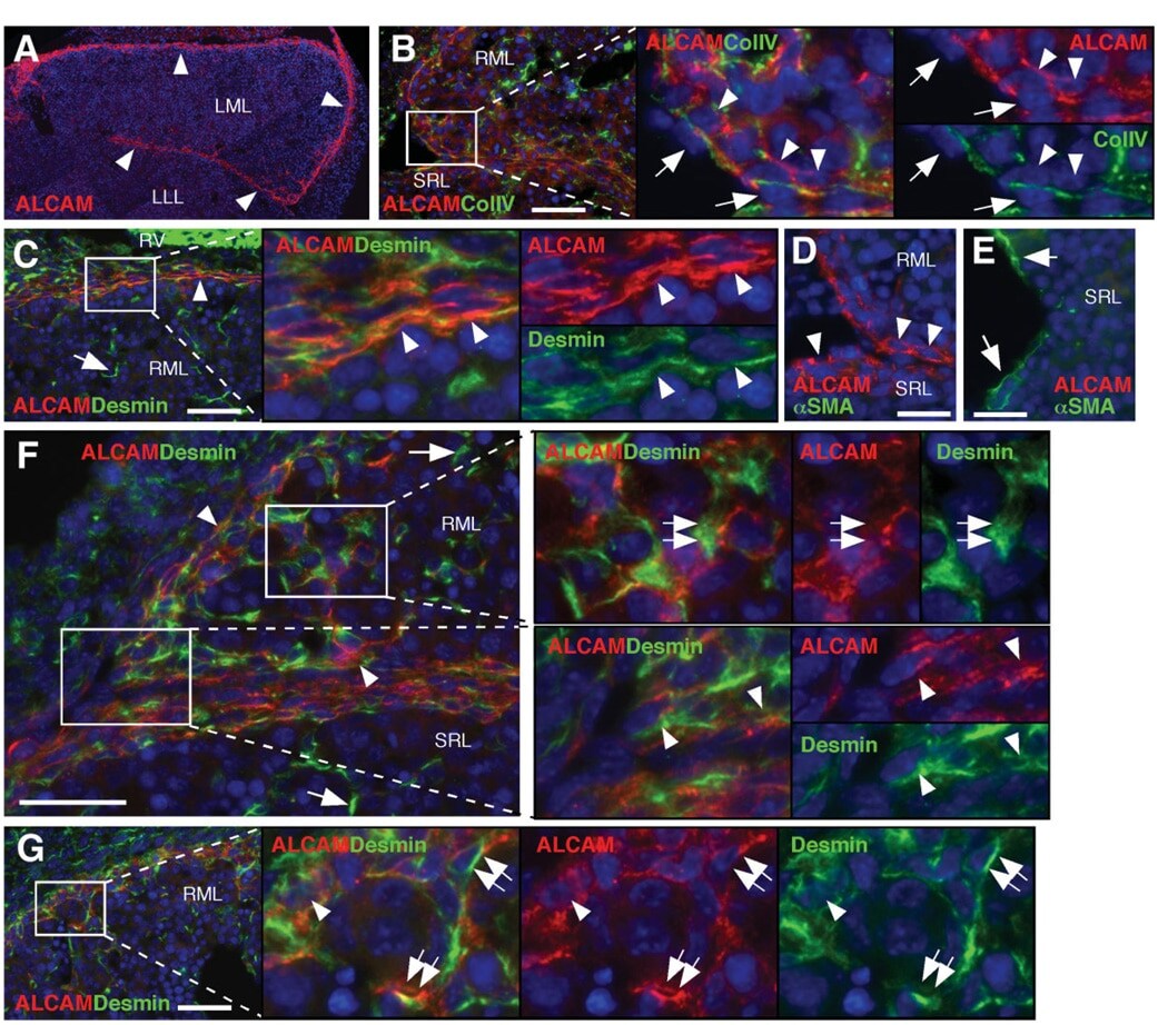 CD166 (ALCAM) Antibody (14-1661-82)