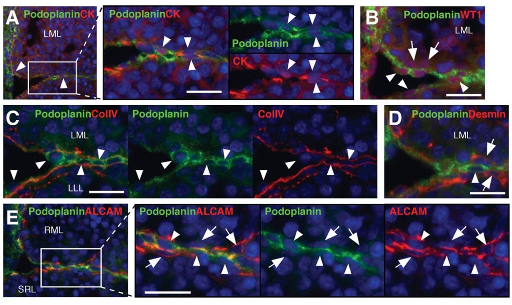 CD166 (ALCAM) Antibody (14-1661-82)