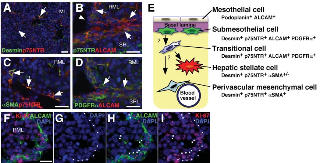 CD166 (ALCAM) Antibody (14-1661-82)