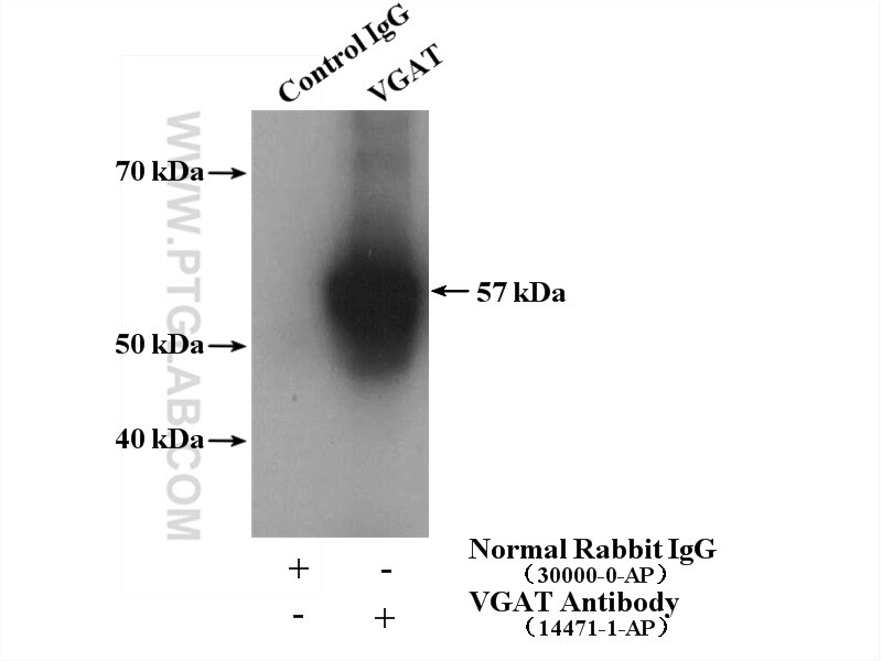 VGAT Antibody (14471-1-AP)