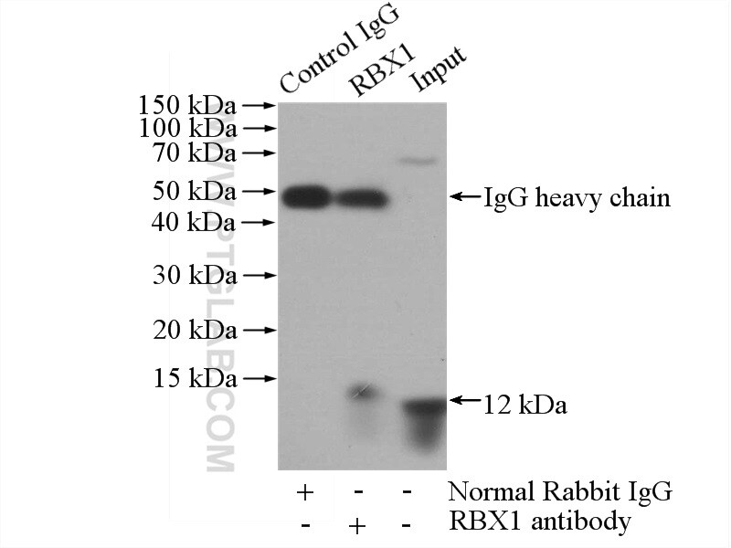 RBX1 Antibody (14895-1-AP)