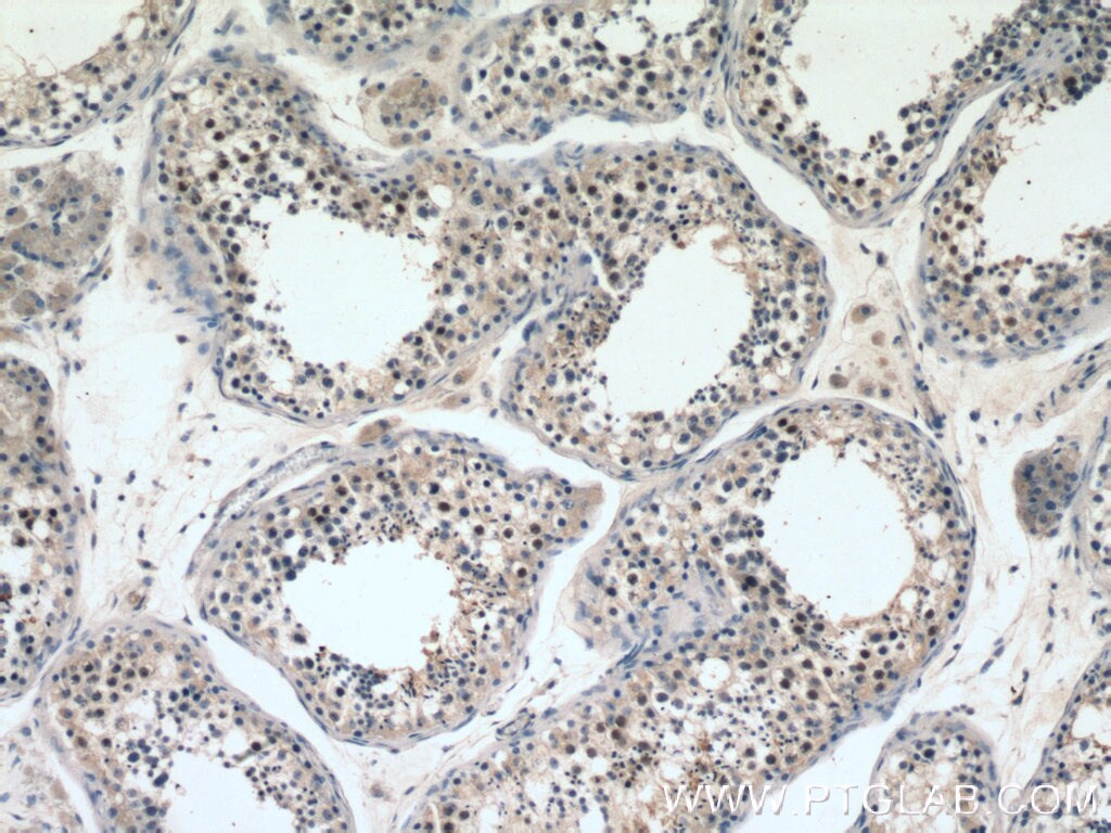 RAD51 Antibody (14961-1-AP)