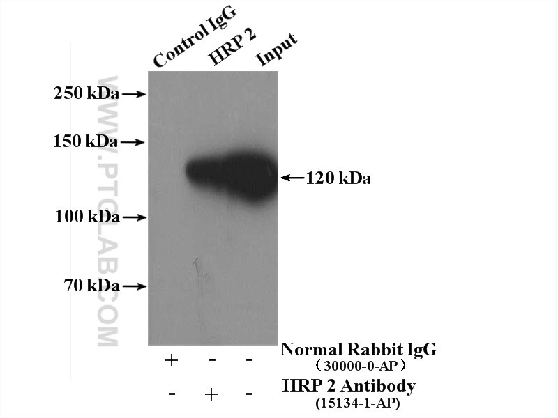 HRP 2 Antibody (15134-1-AP)