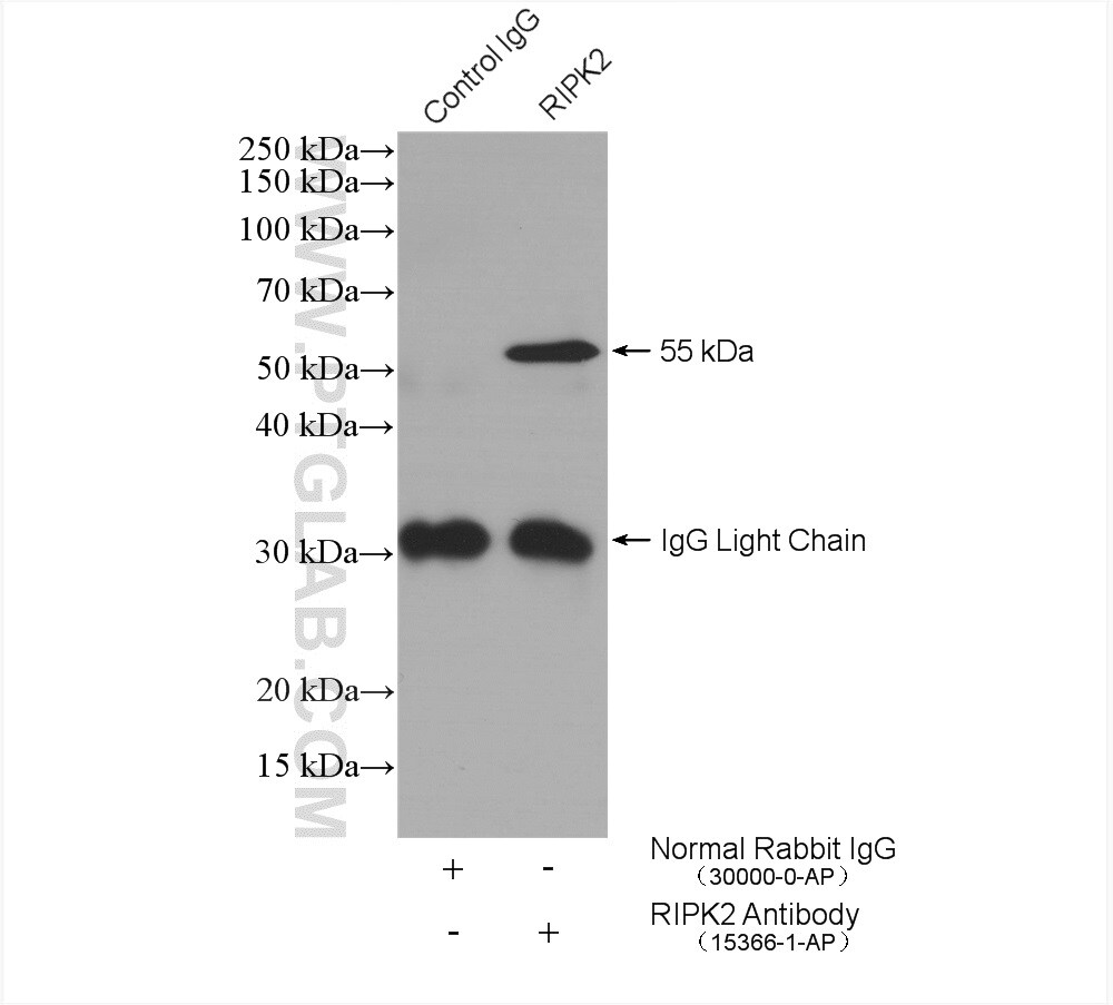 RIPK2 Antibody (15366-1-AP)