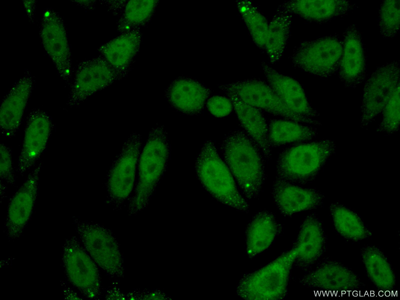 SPOP Antibody (16750-1-AP)