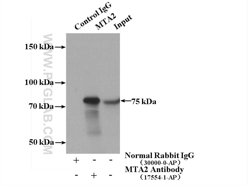 MTA2 Antibody (17554-1-AP)