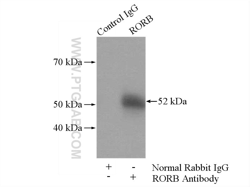 RORB Antibody (17635-1-AP)