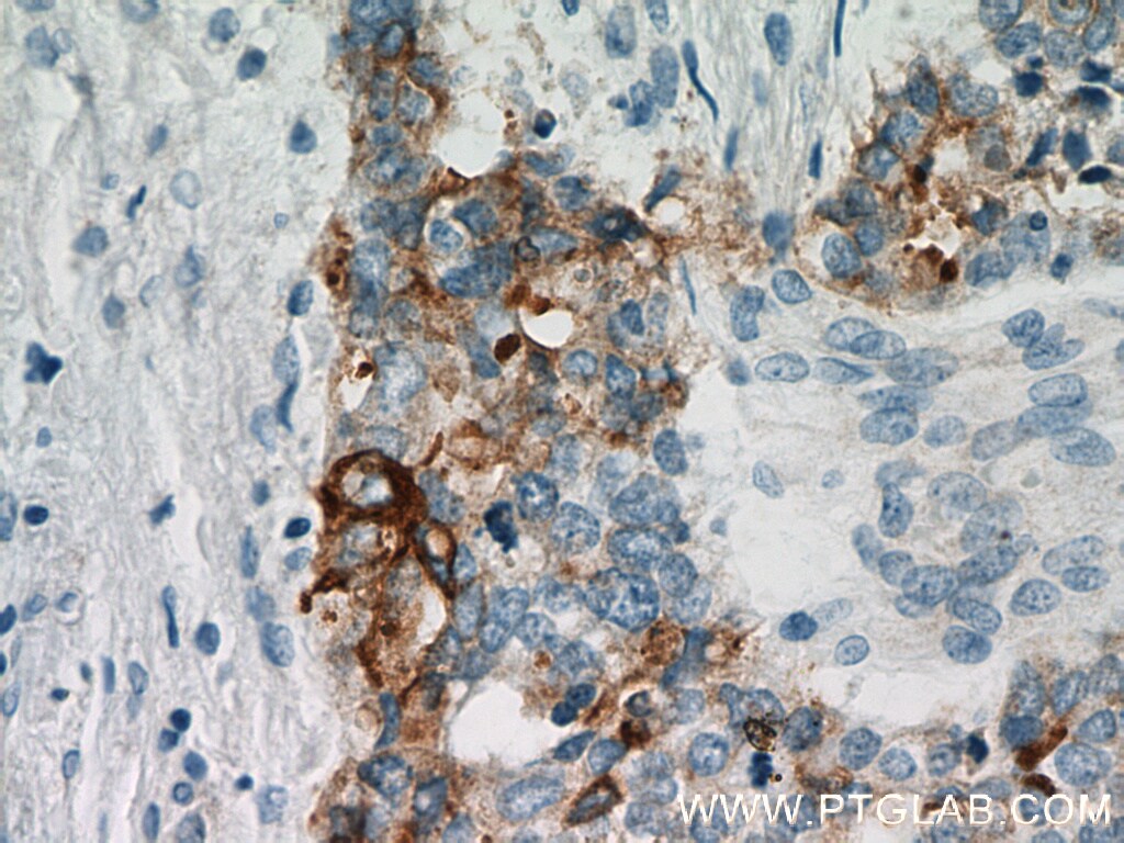 PLAP Antibody (18507-1-AP)