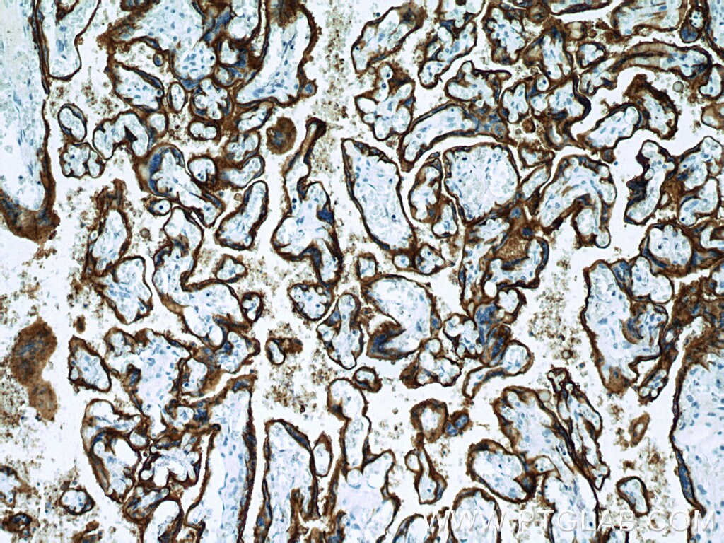 PLAP Antibody (18507-1-AP)