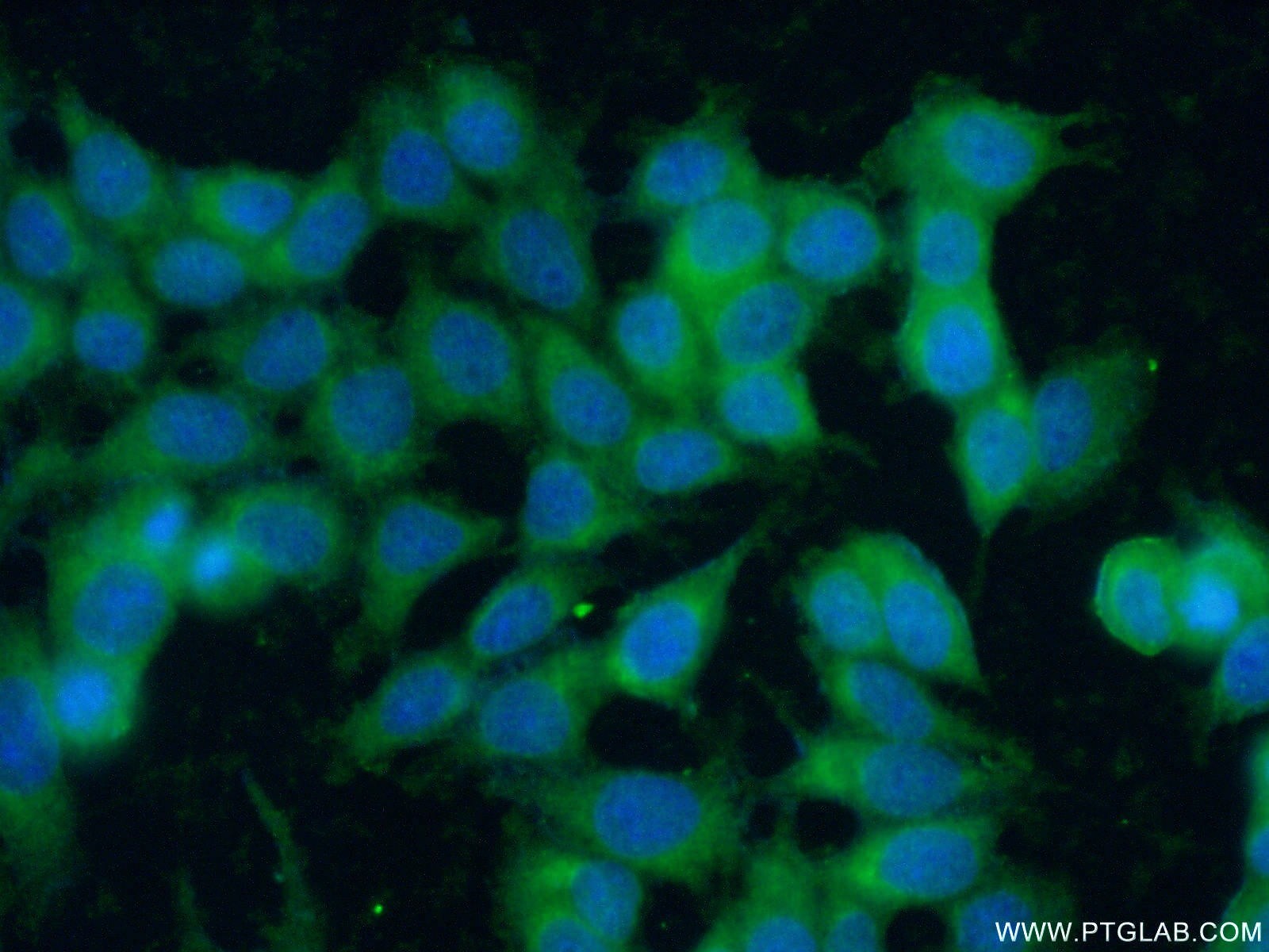c-Kit/CD117 Antibody (18696-1-AP)