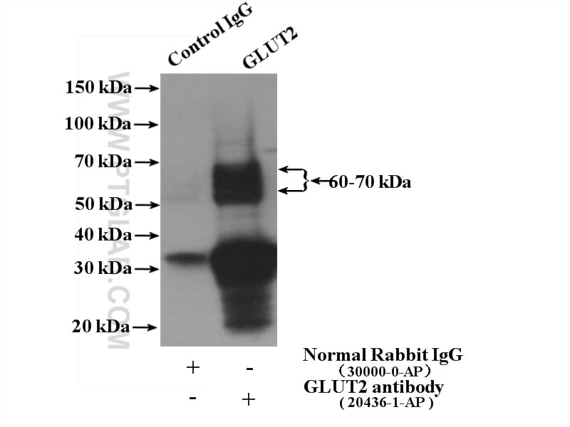 GLUT2 Antibody (20436-1-AP)