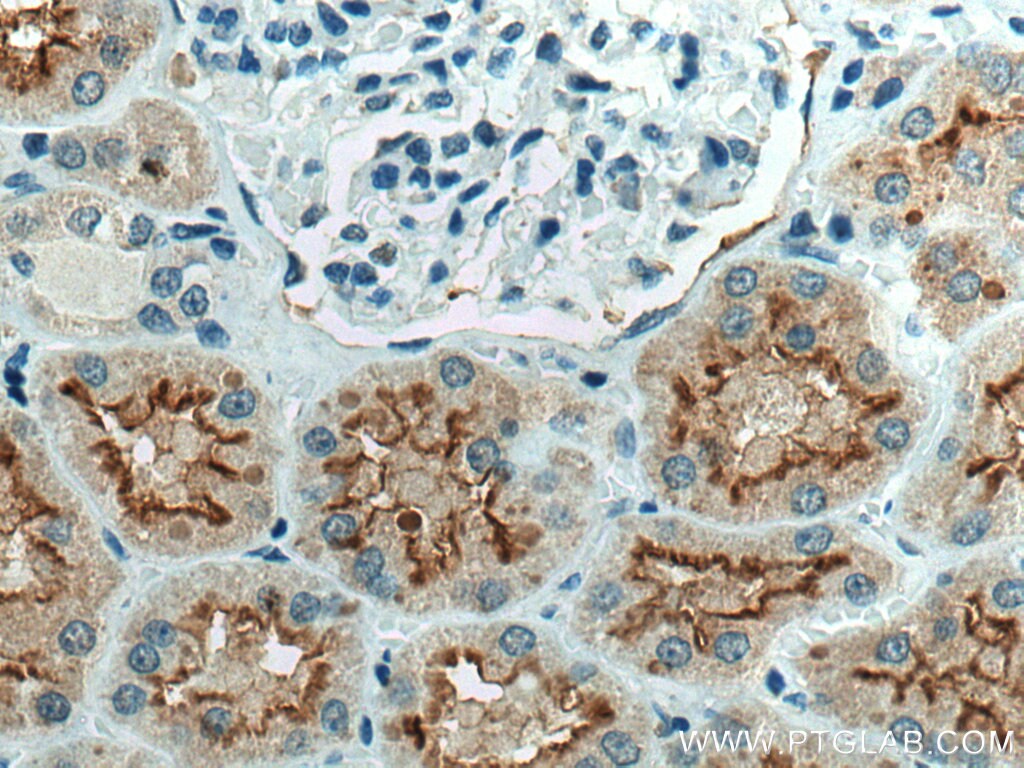 ACE2 Antibody (21115-1-AP)