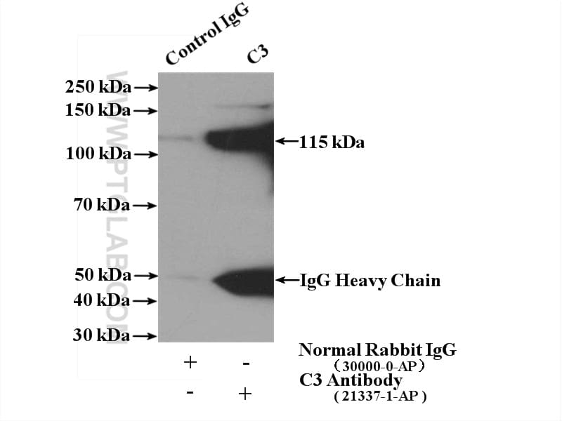 C3/C3b/C3c Antibody (21337-1-AP)