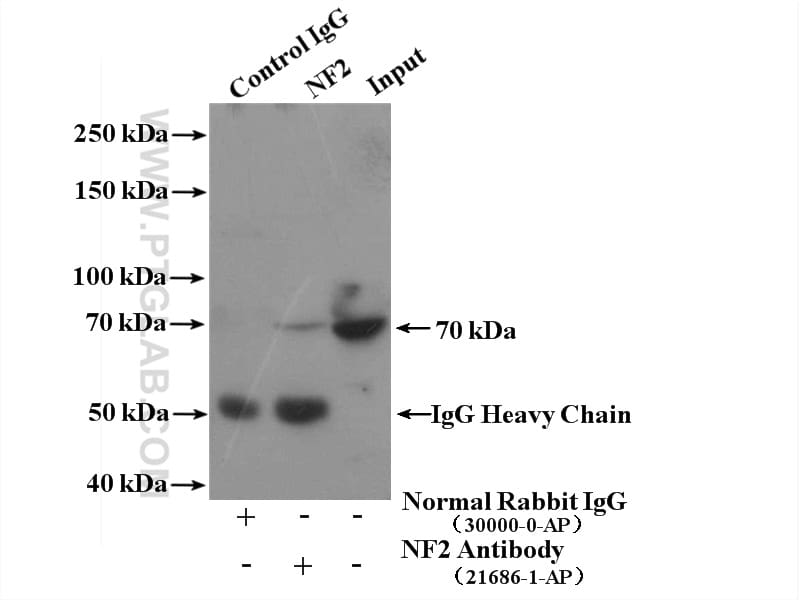 NF2 Antibody (21686-1-AP)