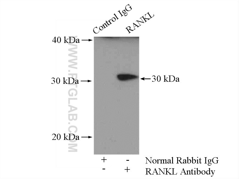 RANKL Antibody (23408-1-AP)