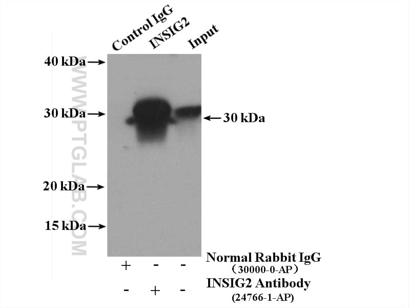INSIG2 Antibody (24766-1-AP)