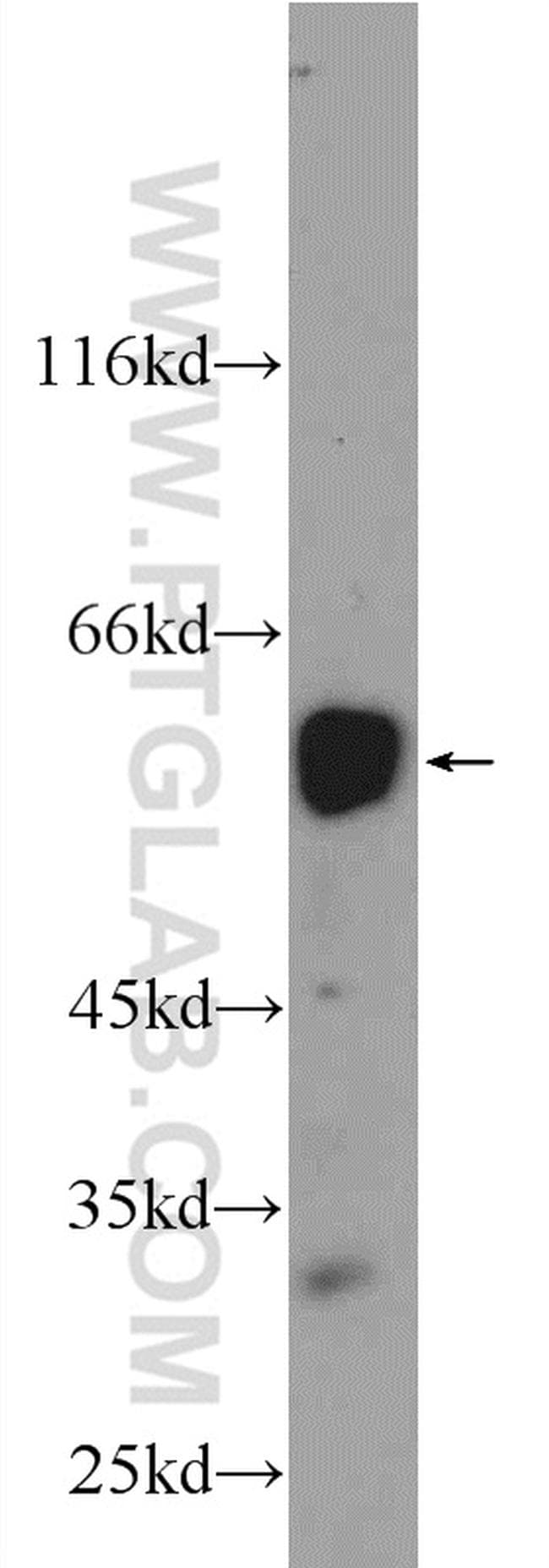 RUNX1 (middle) Antibody (25315-1-AP)